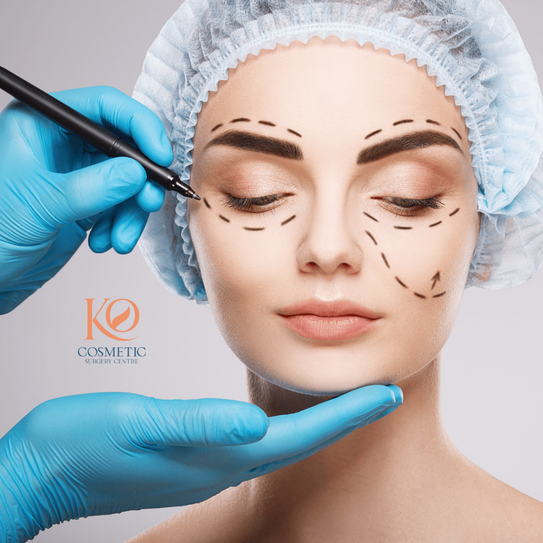 Blepharoplasty (Eyelid Surgery) in Coimbatore: Upper, Lower & Double ...