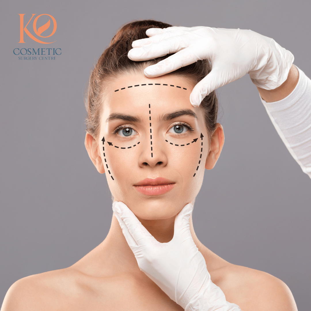 Face Lift Surgery (Rhytidectomy) in Coimbatore: Full, Mini & Mid-Face ...