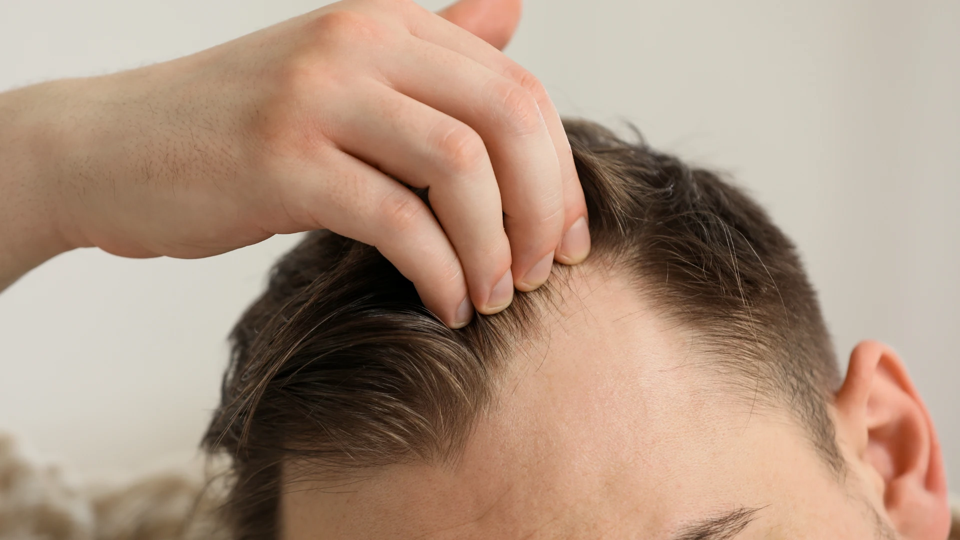 Hairline Correction in Coimbatore: FUE & Forehead Reduction - Ko ...