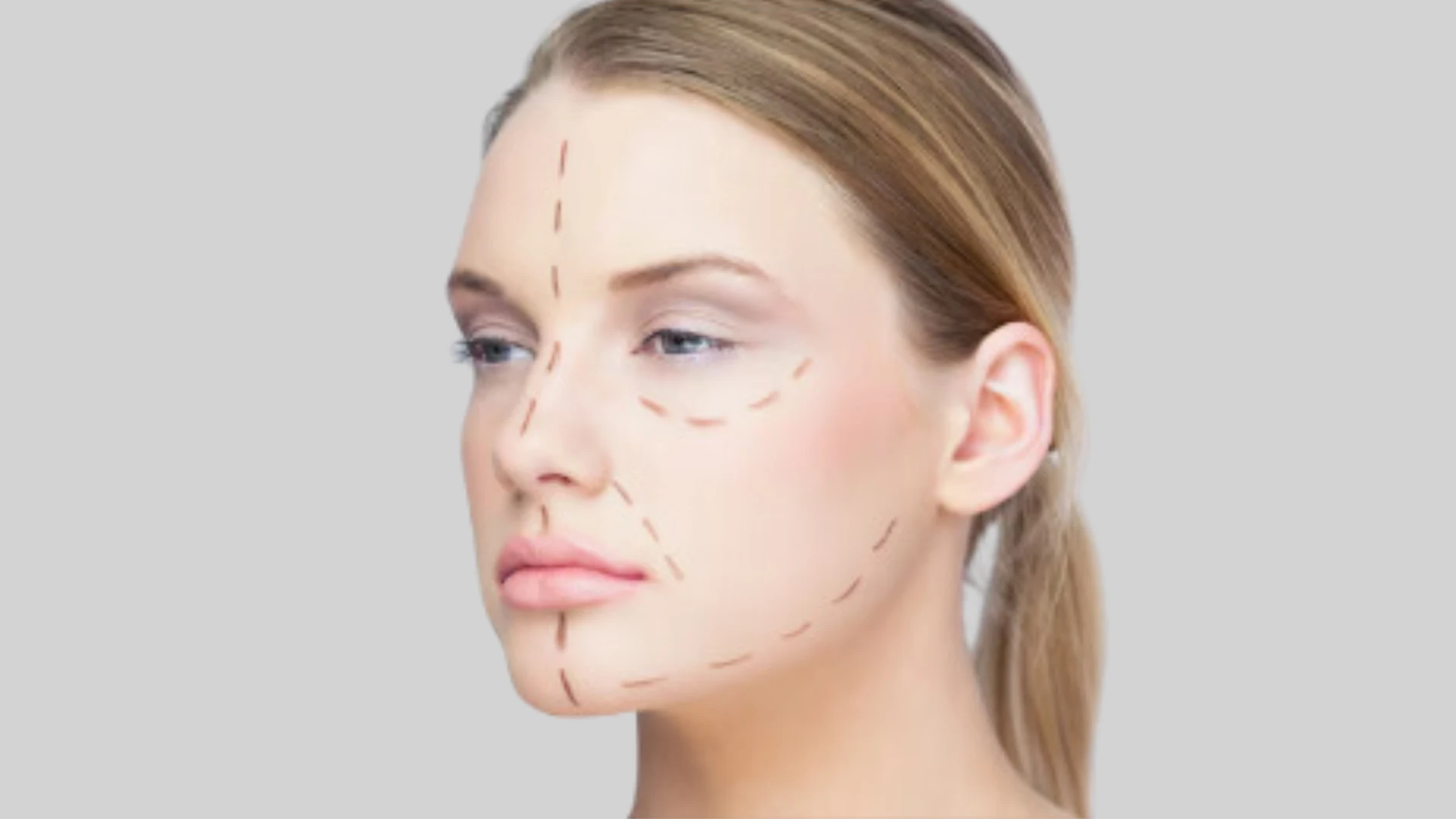 Nano Fat Grafting to Face in Coimbatore: Skin Rejuvenation & Volume ...